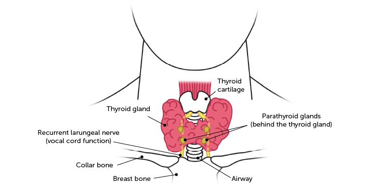 A thyroidectomy is the surgical removal of part or all of the thyroid gland. Learn more from ...